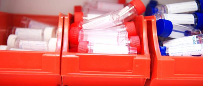 Urine test for HPV as good as cervical smears for detecting cervical ...