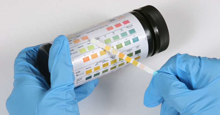 Rapid test could help treat UTIs more effectively | Nursing in Practice