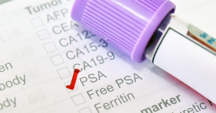 Prostate cancer: Supporting early diagnosis in primary care | Nursing ...